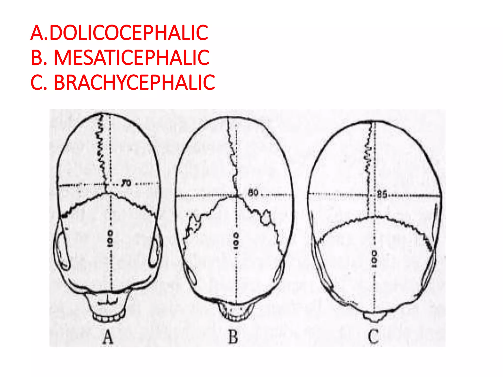 DETERMINATION OF RACE FROM HUMAN REMAINS.pptx Dr. Haricharan MD RIMS ...