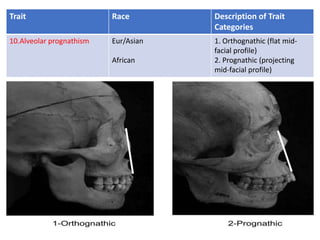 Alveolar Prognathism