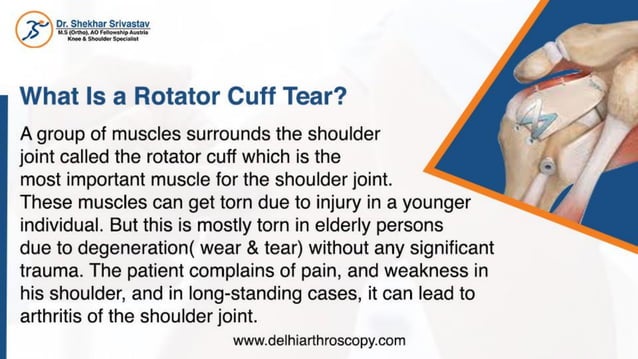 Rotator Cuff Tear Arthroscopy, Rotator Cuff Surgery and Repair by Dr ...