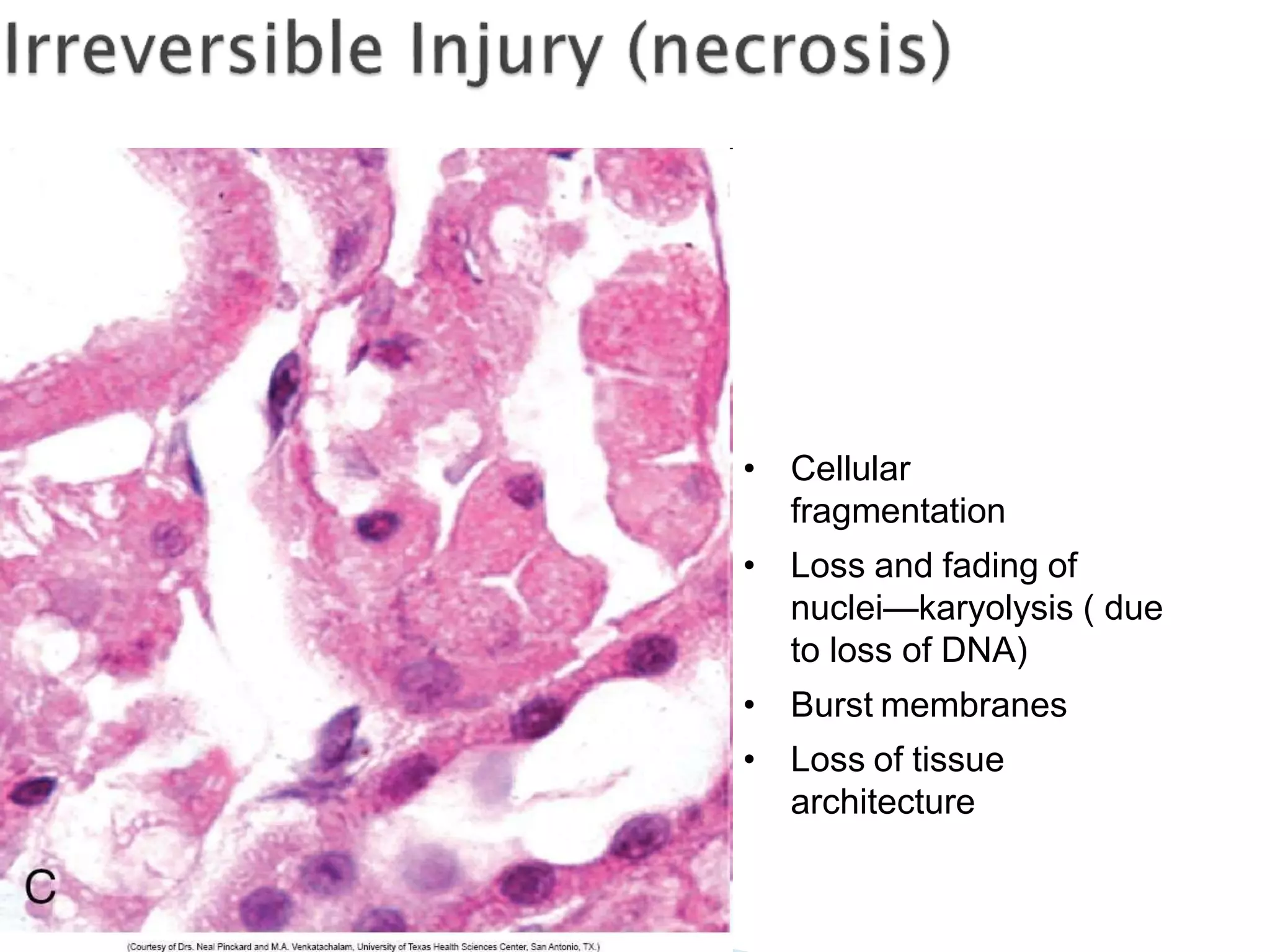 Dr.Jasveer. cell injury presentation.pptx
