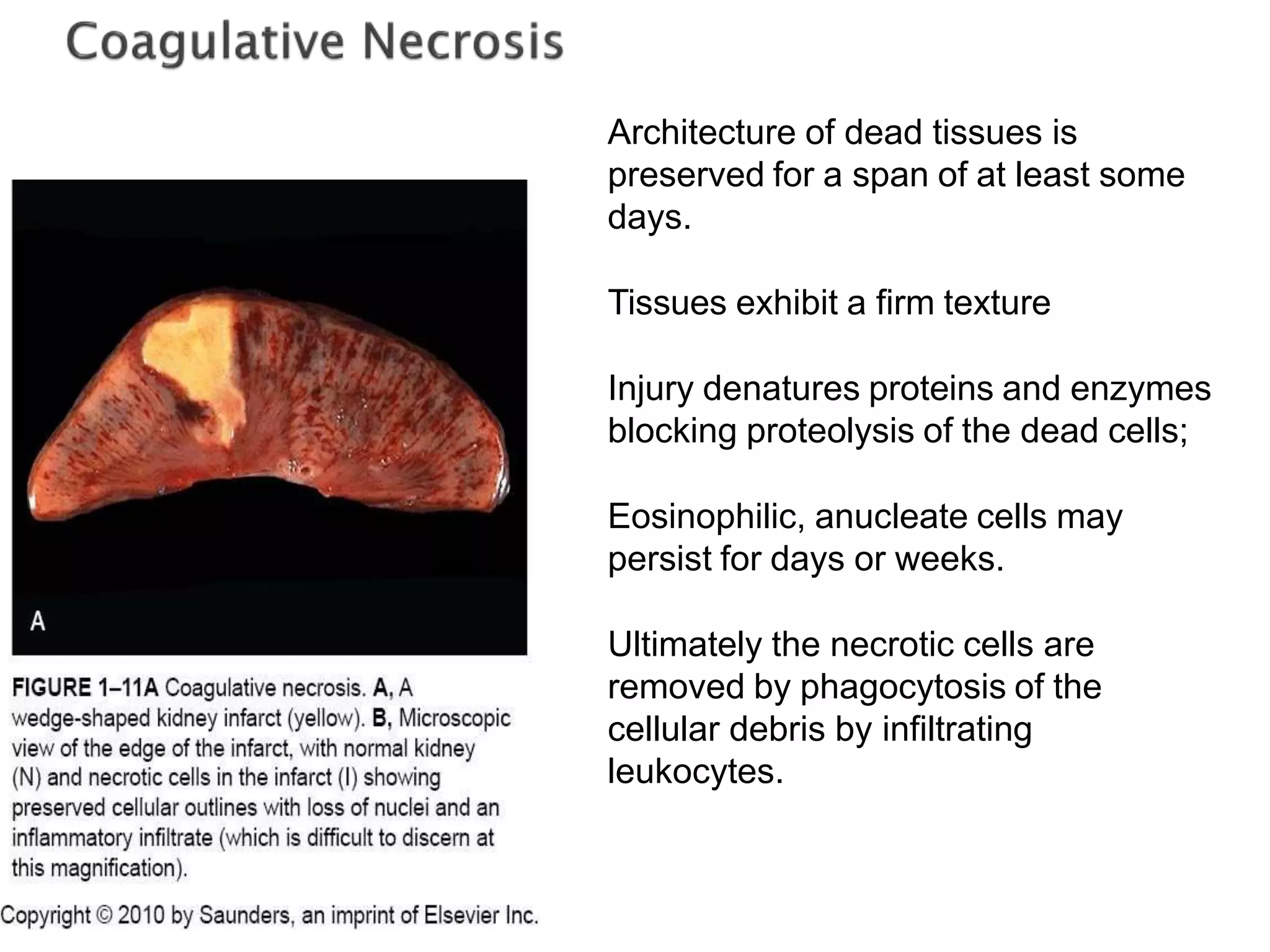 Dr.Jasveer. cell injury presentation.pptx