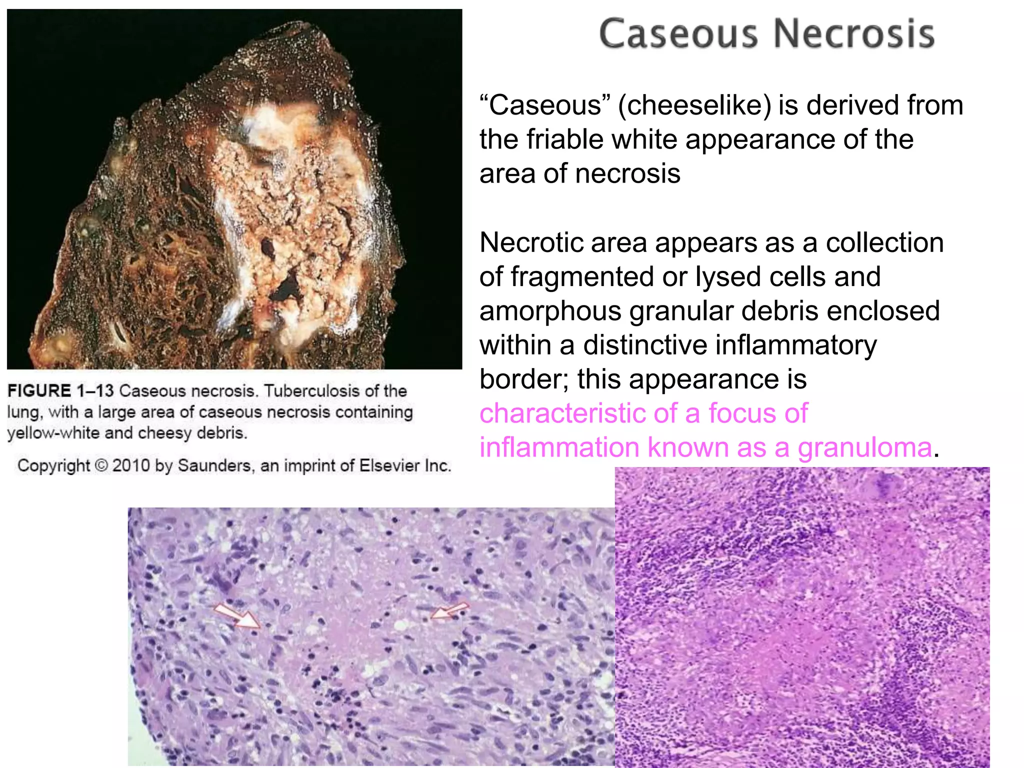 Dr.Jasveer. cell injury presentation.pptx