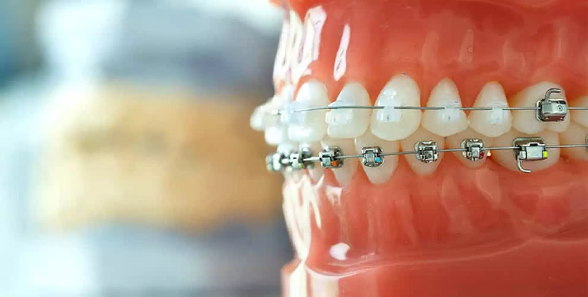 Ensuring proper teeth alignment is vital for gum and oral health. | PDF ...