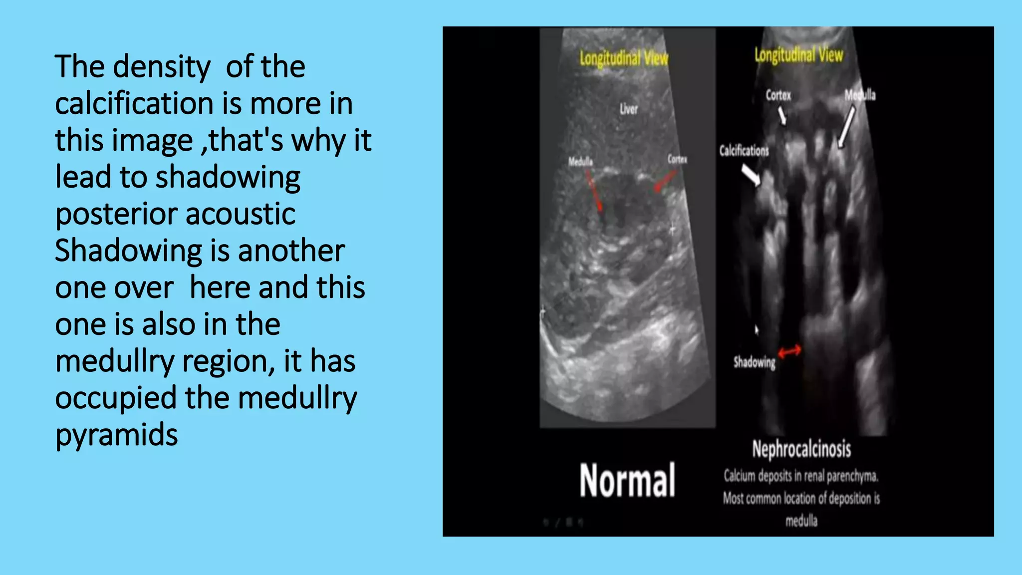 renal us ultrasounograph 1.pptx