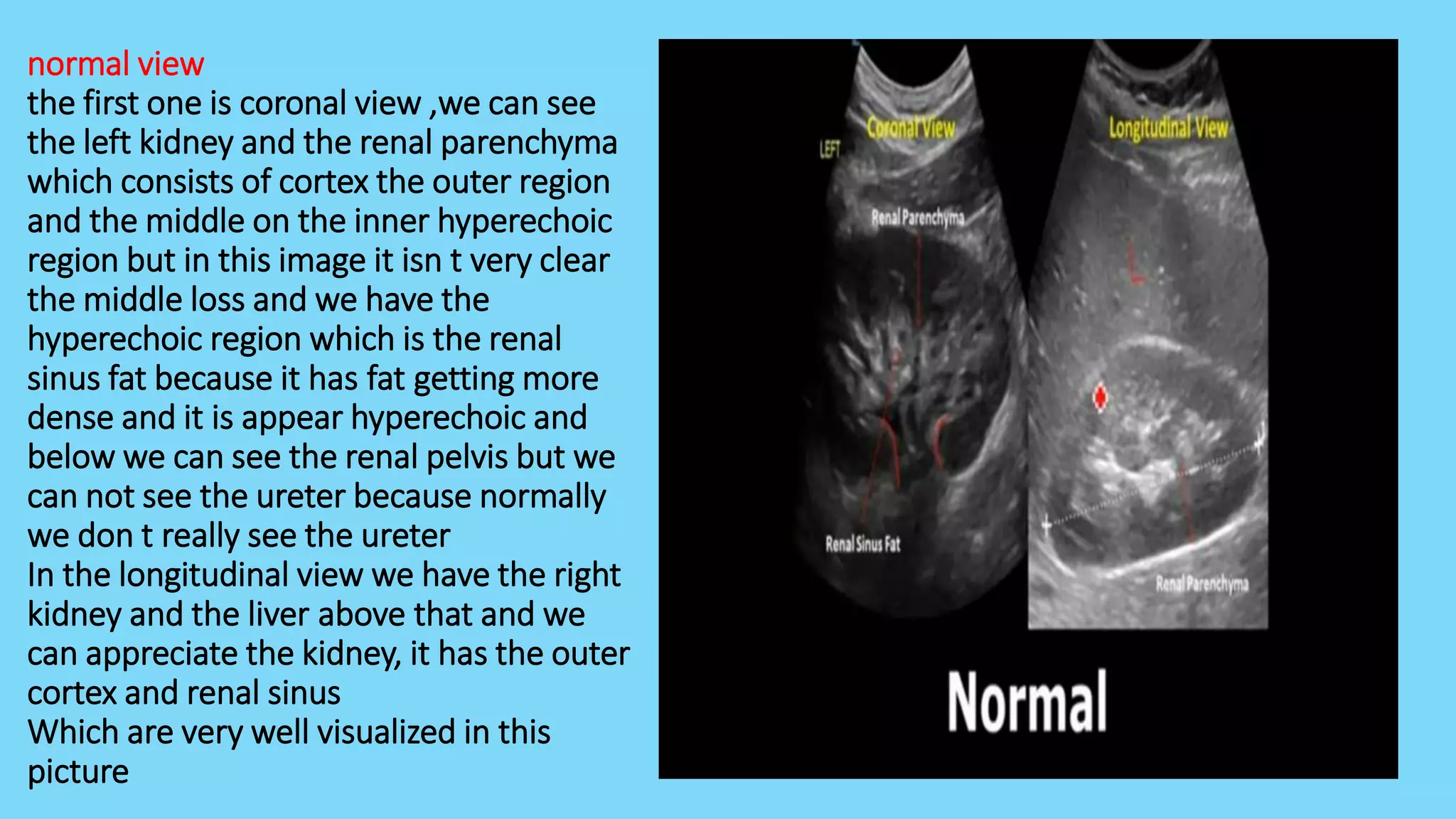 renal us ultrasounograph 1.pptx