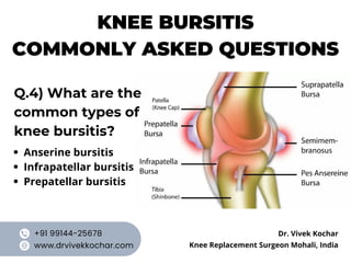 All about Knee Bursitis by Dr. Vivek Kochar Mohali Orthopedic Doctor | PDF