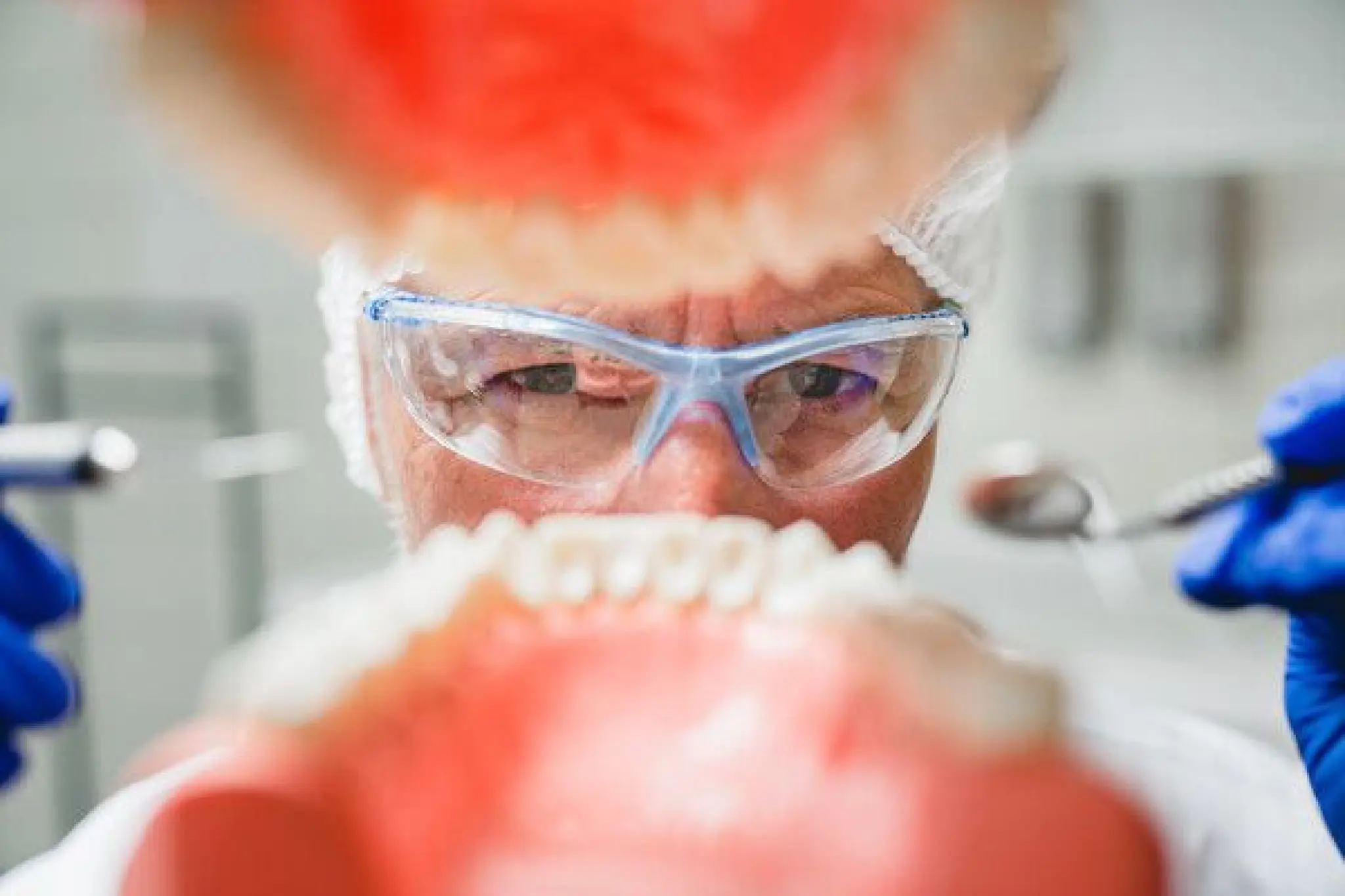 Tooth decay is a slow process that results in cavities | PDF