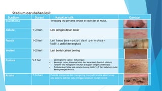 dr.Putu_Monkeypox ppt23_RSPISS.pdf