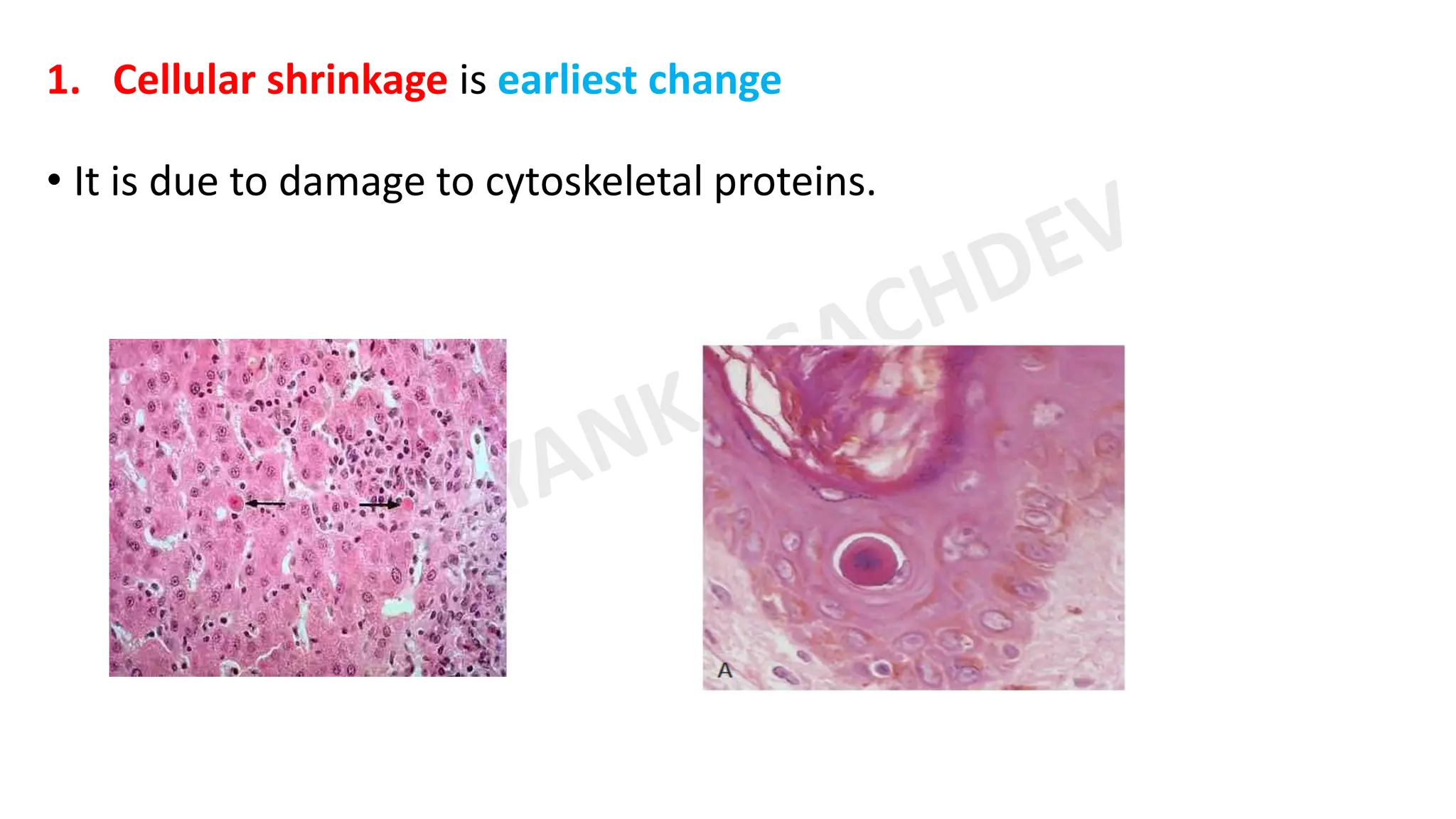 General pathology.pdf by Miss Priyanka sachdev | PDF