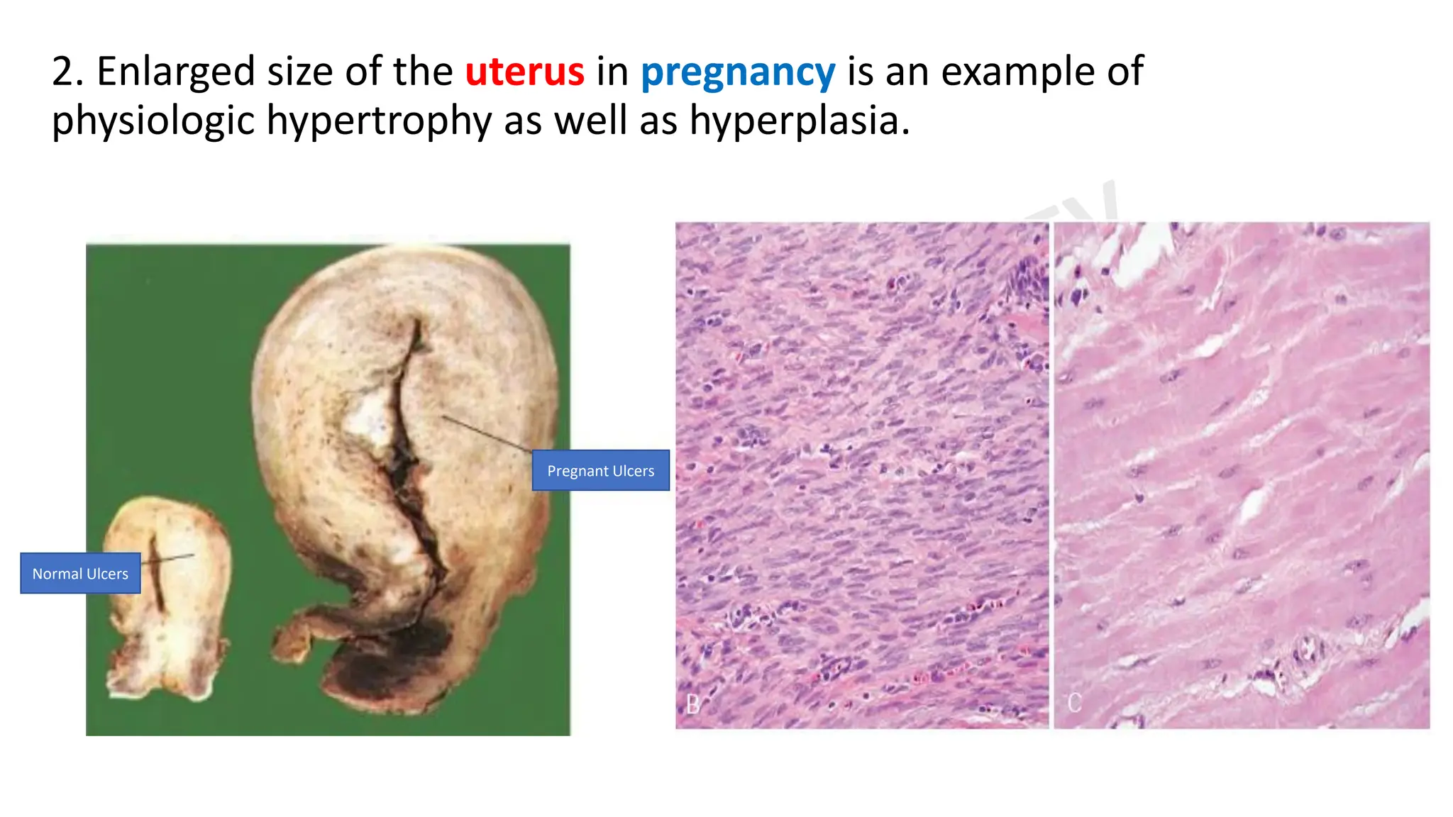 General pathology.pdf by Miss Priyanka sachdev | PDF