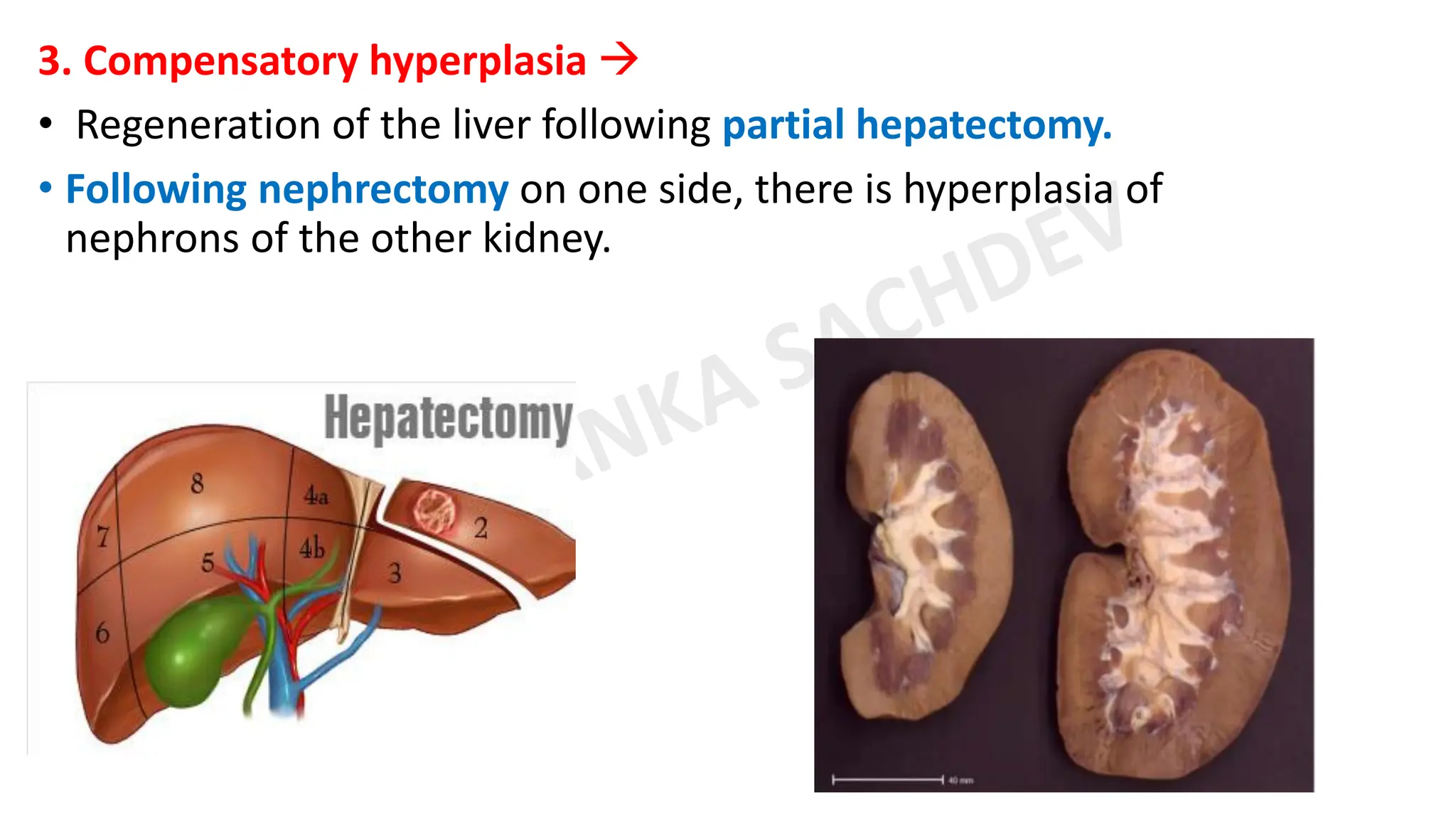 General pathology.pdf by Miss Priyanka sachdev | PDF