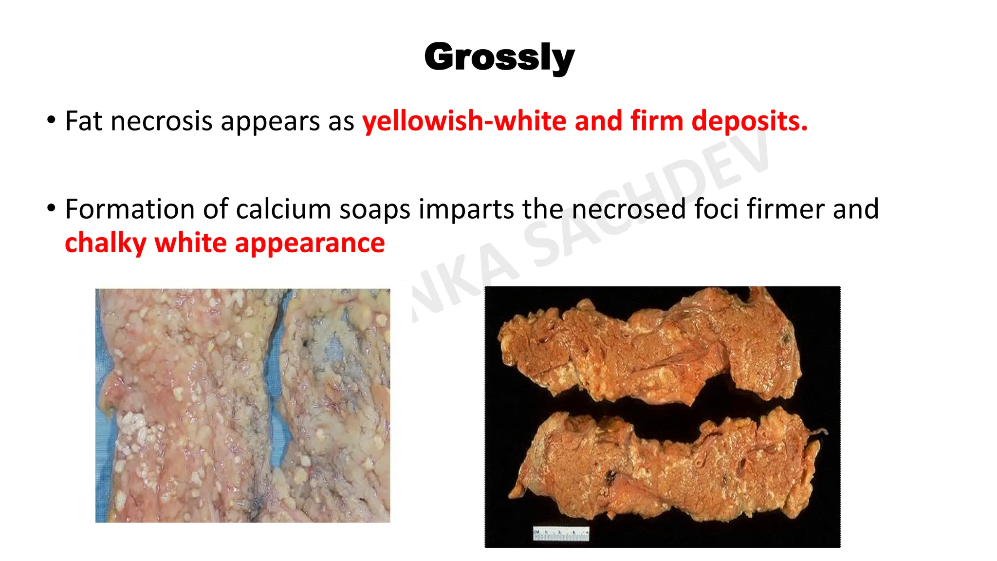 General pathology.pdf by Miss Priyanka sachdev | PDF
