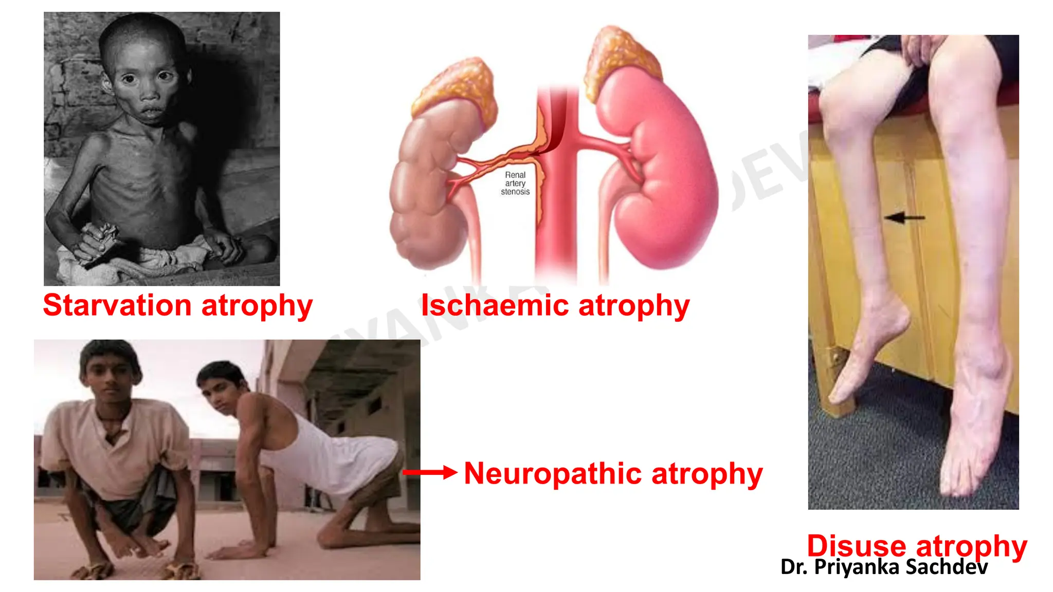 General pathology.pdf by Miss Priyanka sachdev | PDF