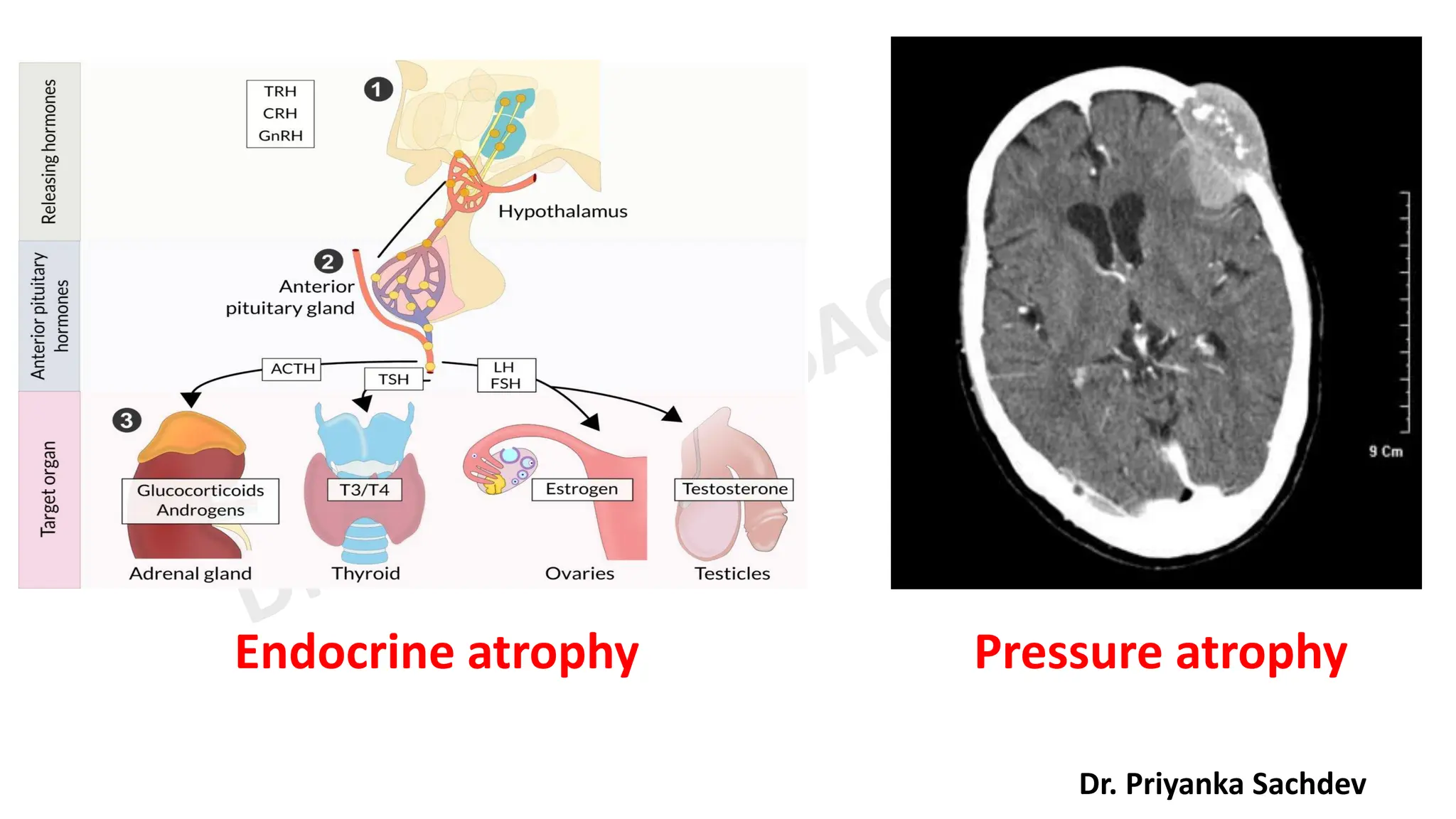 General pathology.pdf by Miss Priyanka sachdev | PDF