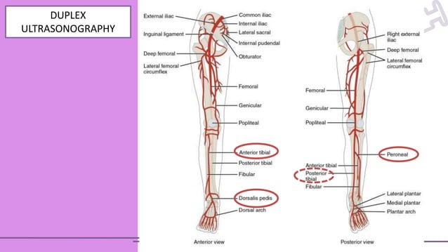 case management presentation on DVT and acute limb ischemia | PPT