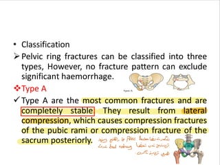 pelvis trauma & damage control surgery and its management | PPT