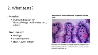 Dr.-Ahmed-Laving-Helicobacter-pylori-Infection.pptx
