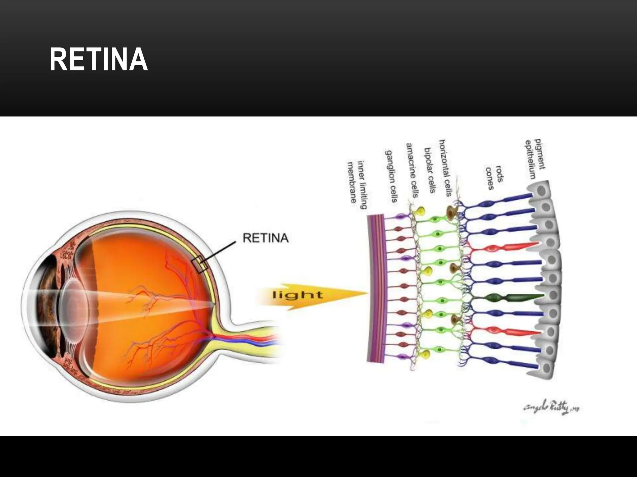 diabetic retinopathy detection using cnn | PPT
