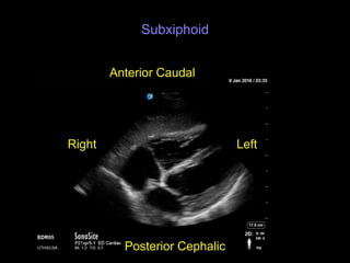 Ecografías en emergencias-UT Health-Dr. Wayman.pptx