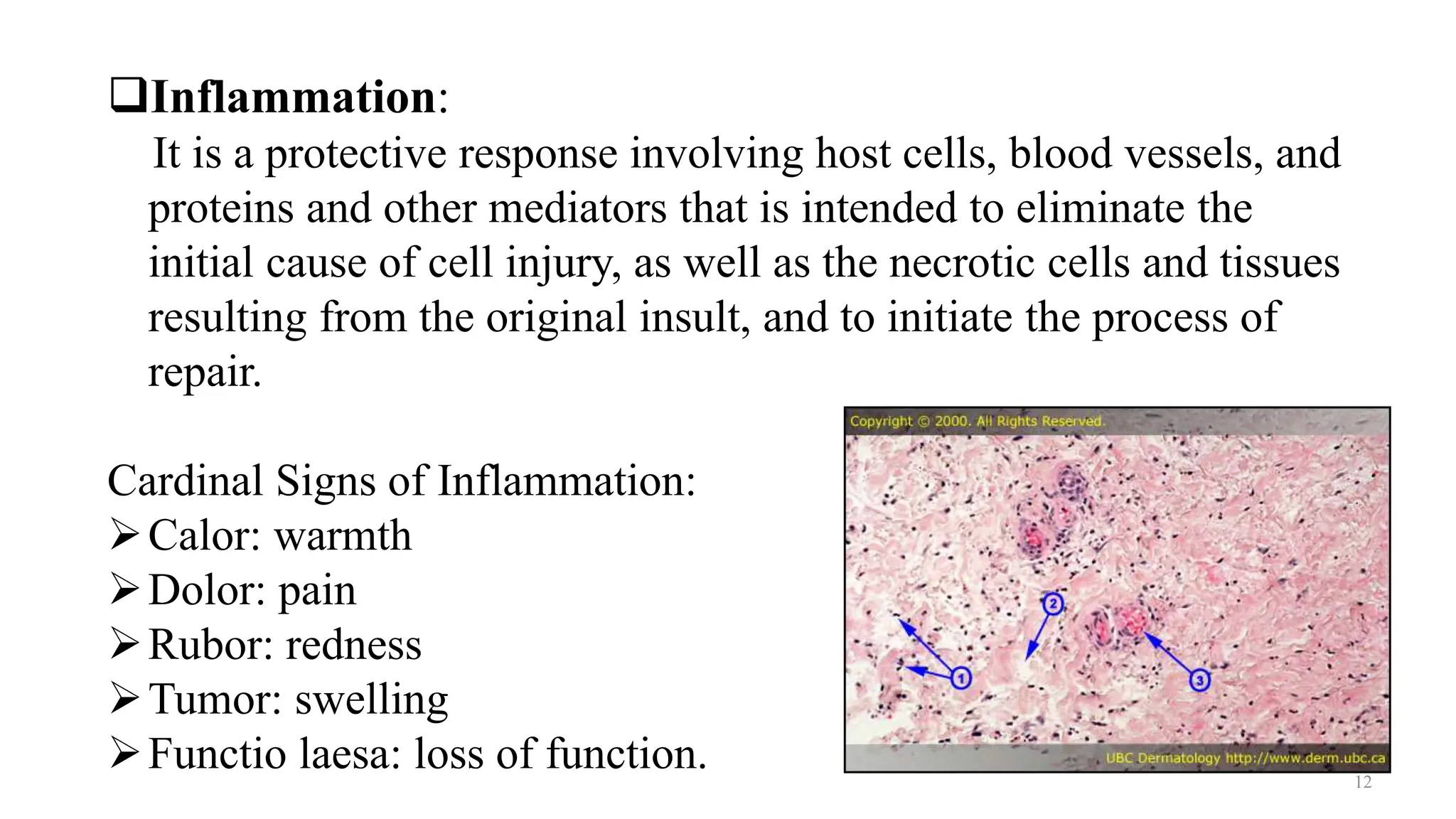 Preseptal Cellulitis & Orbital Cellulitis -Dr. Prabhat Devkota.pptx | Ear, Nose and Throat ...