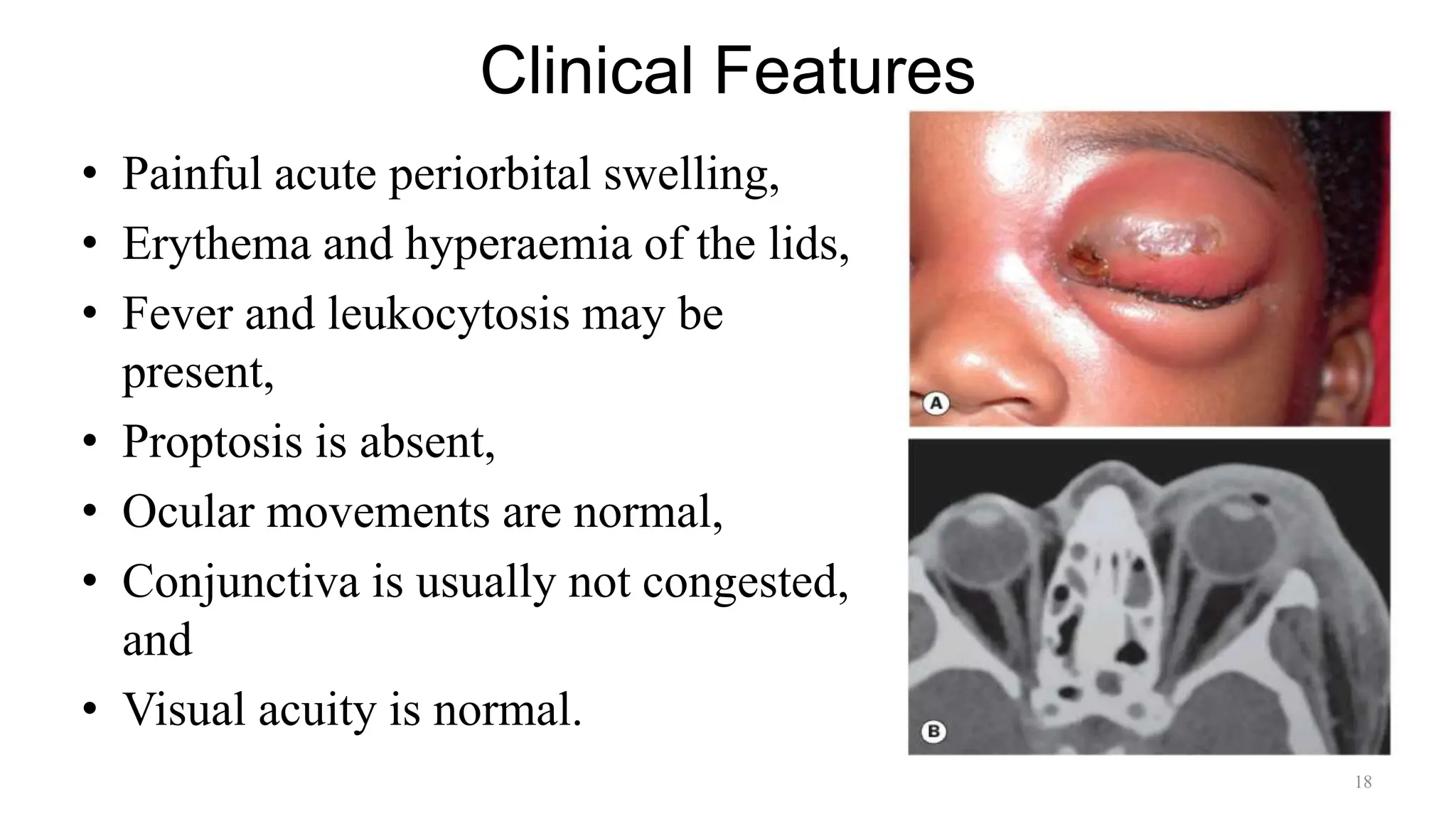 Preseptal Cellulitis & Orbital Cellulitis -Dr. Prabhat Devkota.pptx ...