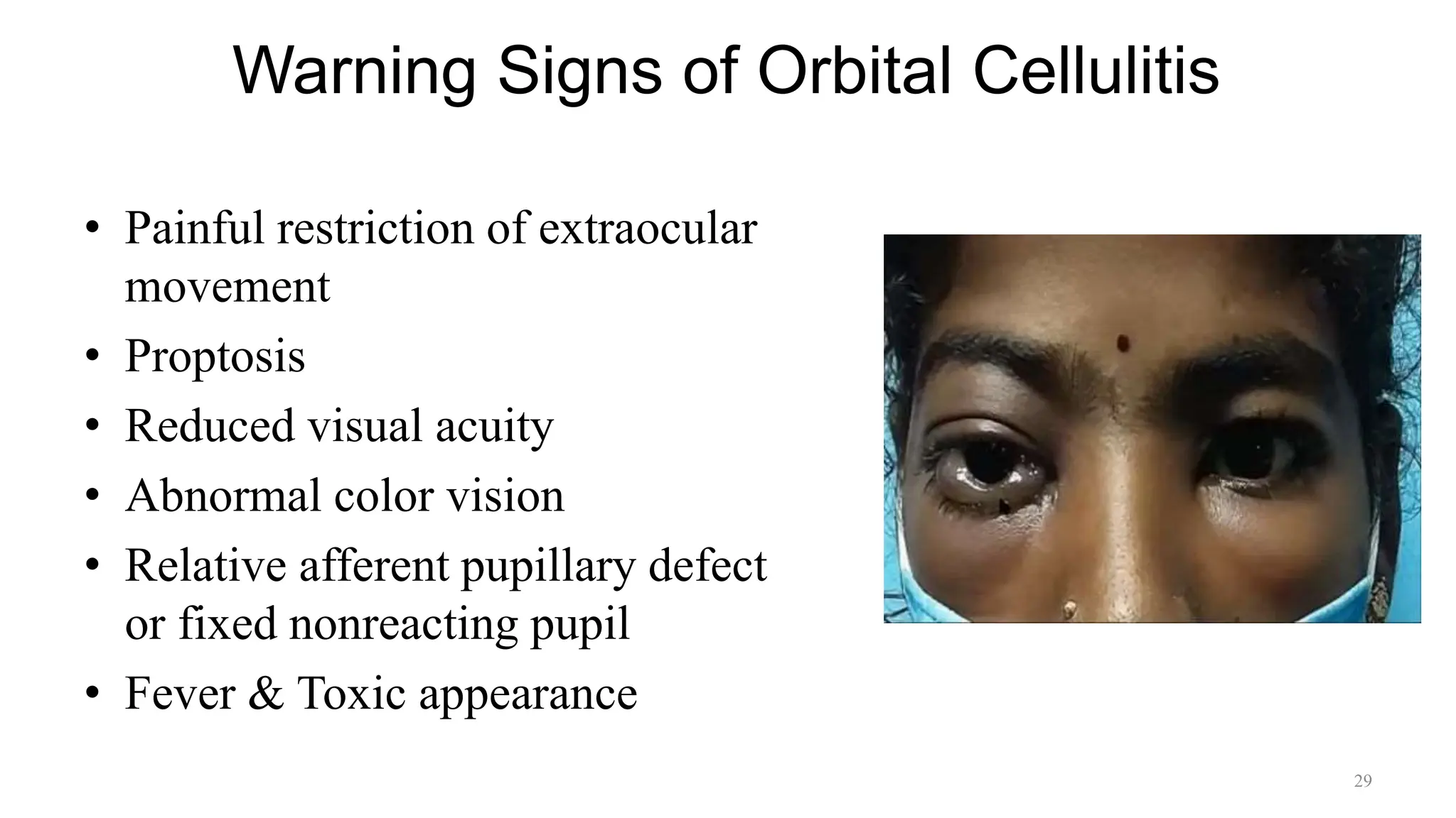 Preseptal Cellulitis & Orbital Cellulitis -Dr. Prabhat Devkota.pptx
