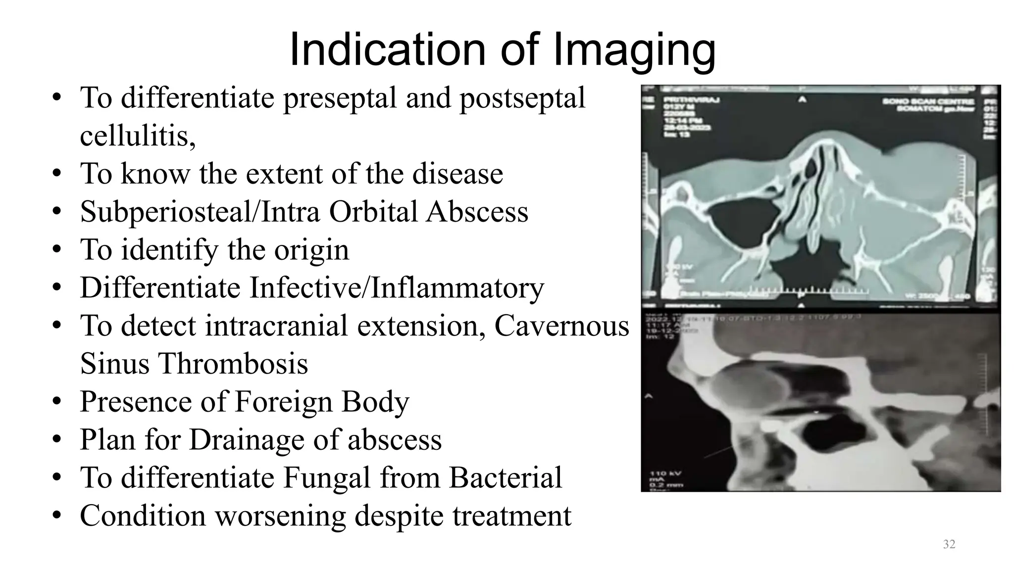 Preseptal Cellulitis & Orbital Cellulitis -Dr. Prabhat Devkota.pptx