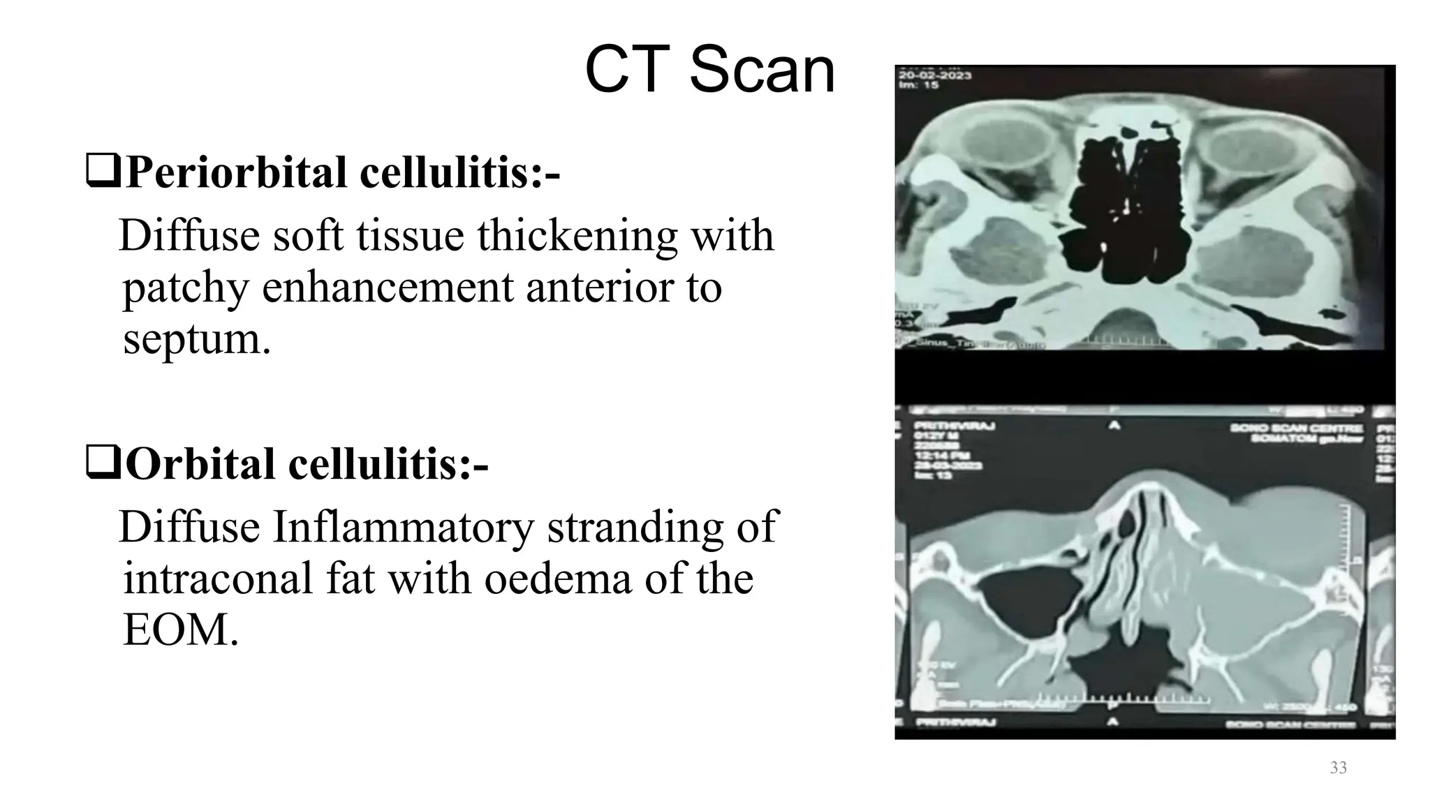 Preseptal Cellulitis & Orbital Cellulitis -Dr. Prabhat Devkota.pptx