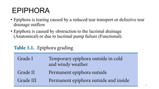 CAUSES AND EVALUATION OF EPIPHORA-DR.PRABHAT DEVKOTA.pptx