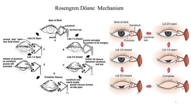 CAUSES AND EVALUATION OF EPIPHORA-DR.PRABHAT DEVKOTA.pptx | Eye and ...