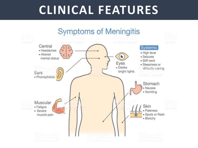 DR. RAM JIBAN MENINGITIS PPT FINAL.pptx gds | PPT