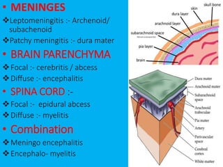 DR. RAM JIBAN MENINGITIS PPT FINAL.pptx gds | PPTX