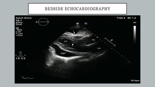 MANAGEMENT OF ACUTE TRAUMA IN ER - CARDIOLOGIST PERSPECTIVE.pptx