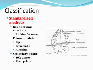 Dr. Saad Gasgus cleft lip and palate-1 (Muhadharaty).ppt