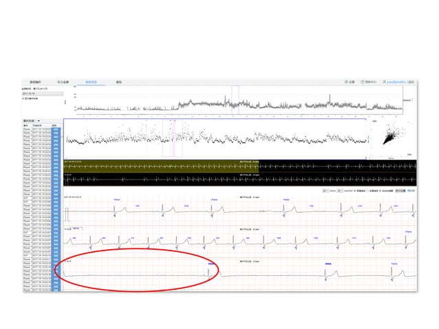 Dr. kush JHRS 2024 internal loop recorder (1).pptx