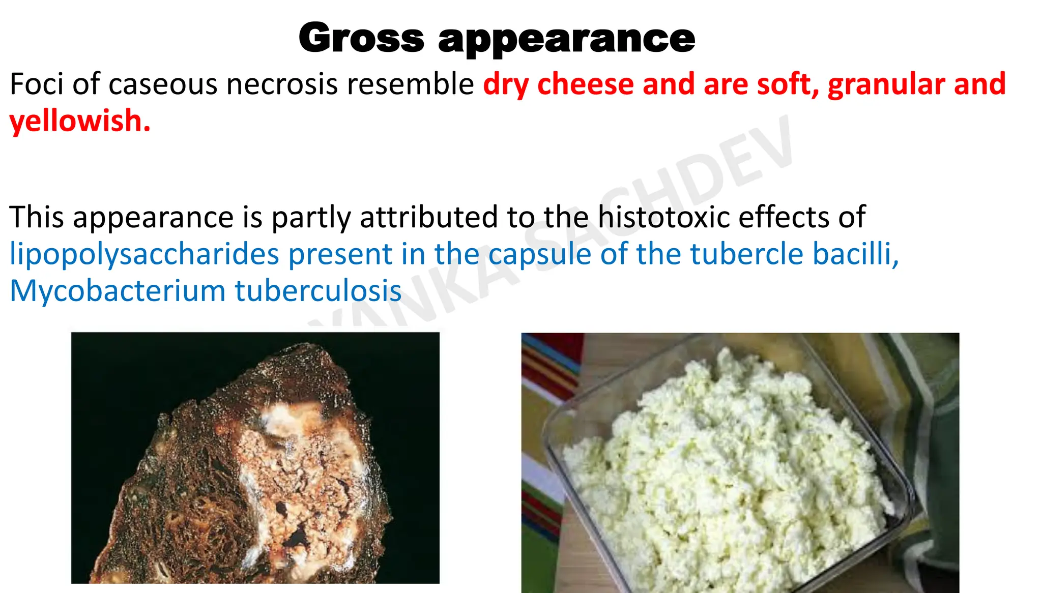 Dr. Priyanka Sachdev - General pathology.pdf