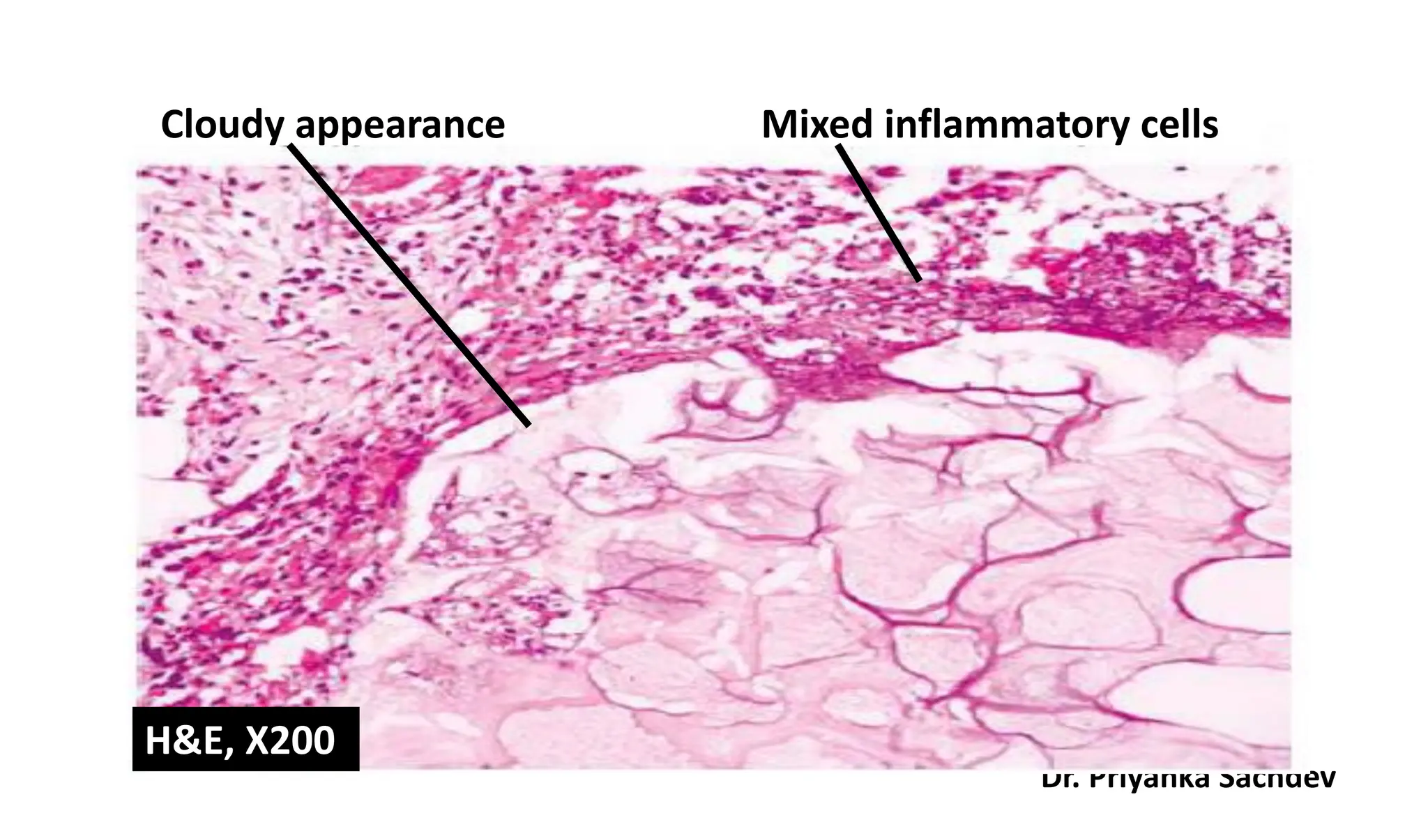 Dr. Priyanka Sachdev - General pathology.pdf