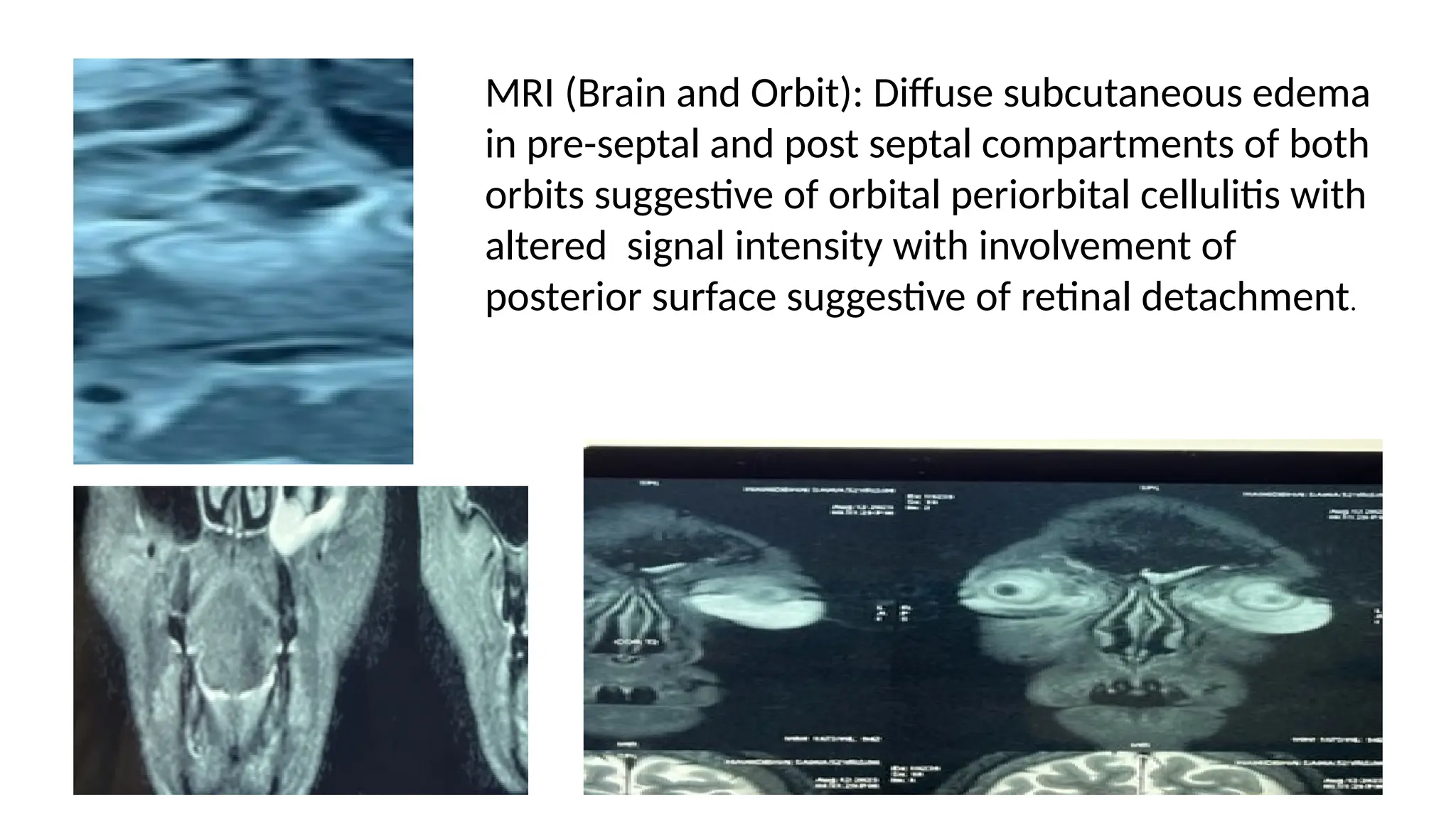 Dr. Pandya and the Poster of the pr.pptx