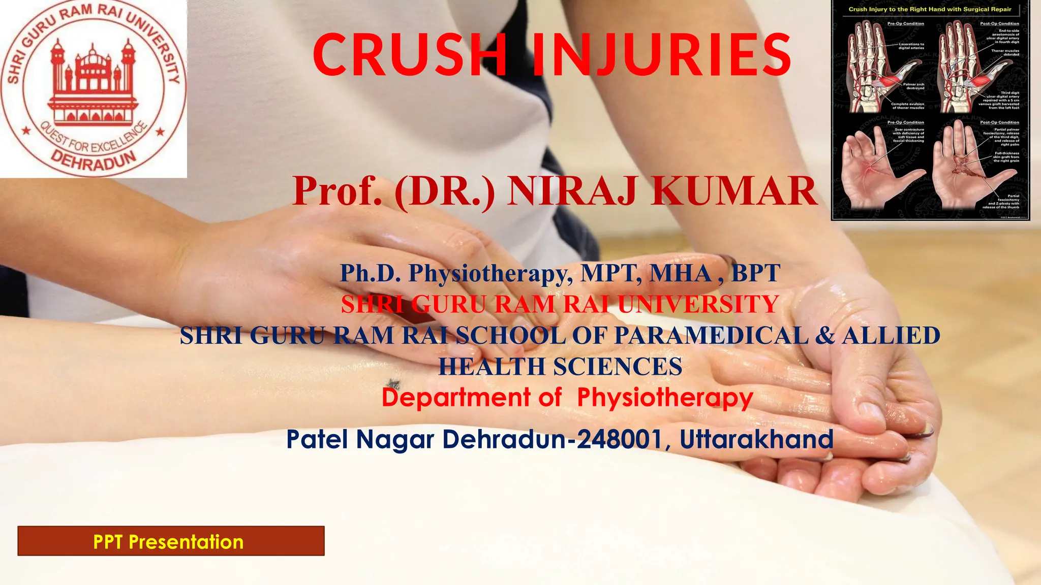 Prof. (DR.) NIRAJ KUMAR Crush Injury A crush injury of the hand is a way of injuring the hand ...