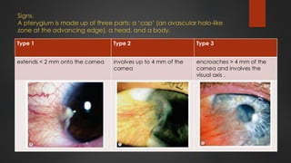 DR. seng serey Day 2A.pdf................ | PDF