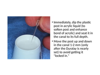 Dr.Mutaz post and core-2 (Muhadharaty).ppt