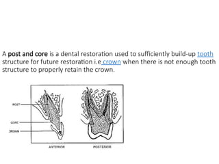 Dr.Mutaz post and core-2 (Muhadharaty).ppt