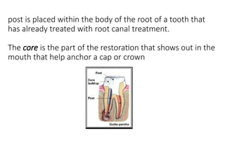 Dr.Mutaz post and core-2 (Muhadharaty).ppt