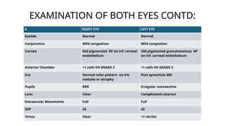 Dr. Sobia Ali PPT Feb-2025 (Sarcoidosis uveitis) | PPT