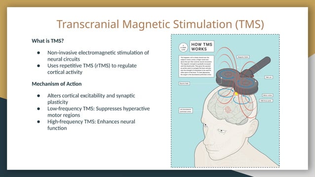 Advanced in neurostimulation for focal dystonia.pptx