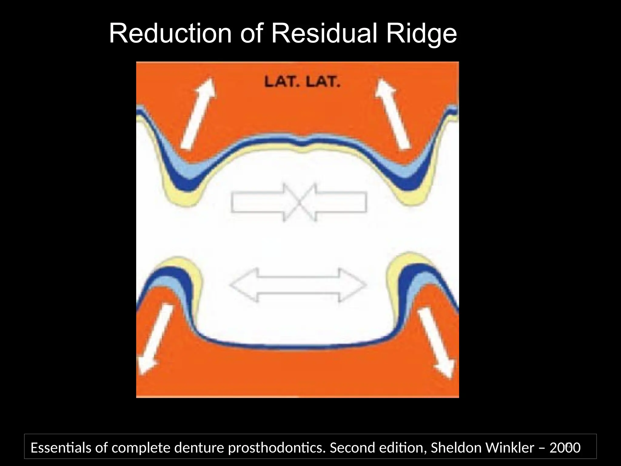 occlusion.................................................. | PPTX