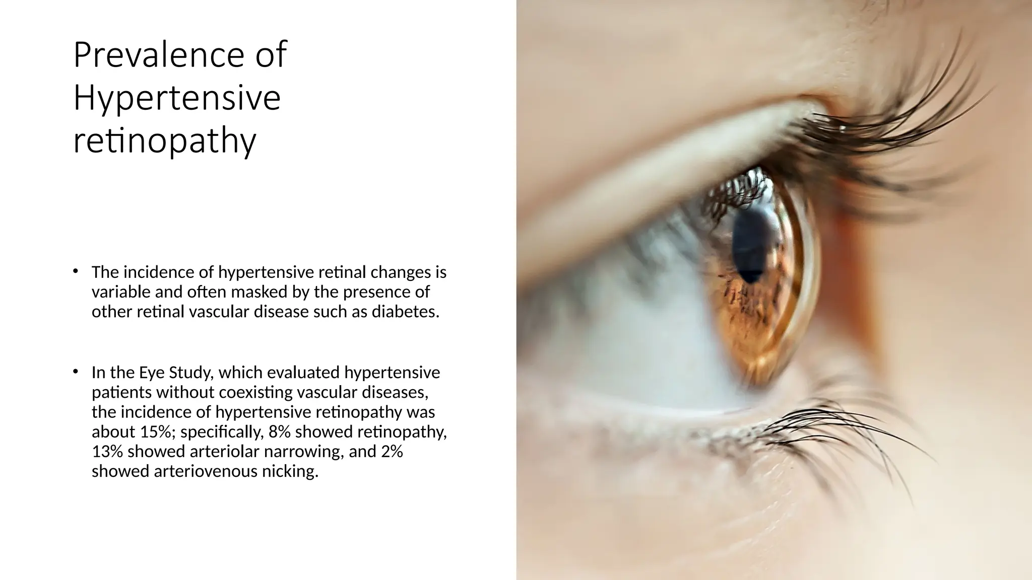 Dr. Hypertension Oph hypertensive retinopathy.pptx