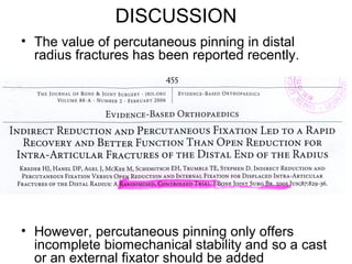 Percutaneous pinning of distal radius (old technique) | PDF