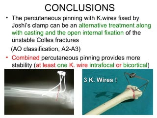 Percutaneous pinning of distal radius (old technique) | PPT