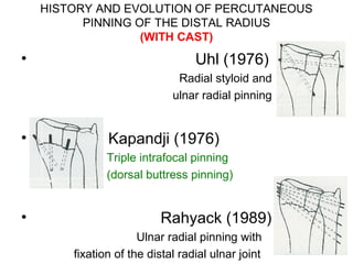 Percutaneous pinning of distal radius (old technique) | PDF